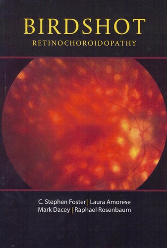 Birdshot Retinochoroidopathy | Uveitis.org | OIUF